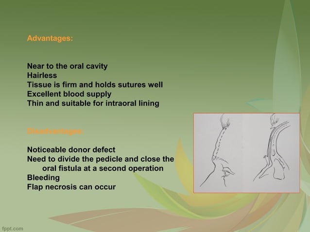 Local flaps in head & neack reconstruction | PPT | First Aid | Injuries