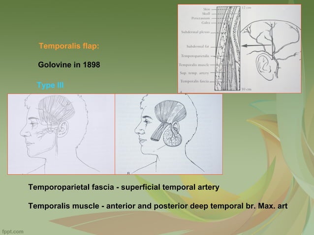 Local flaps in head & neack reconstruction | PPT | First Aid | Injuries