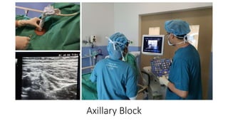 Local and regional anaesthesia in hand surgery | PPTX