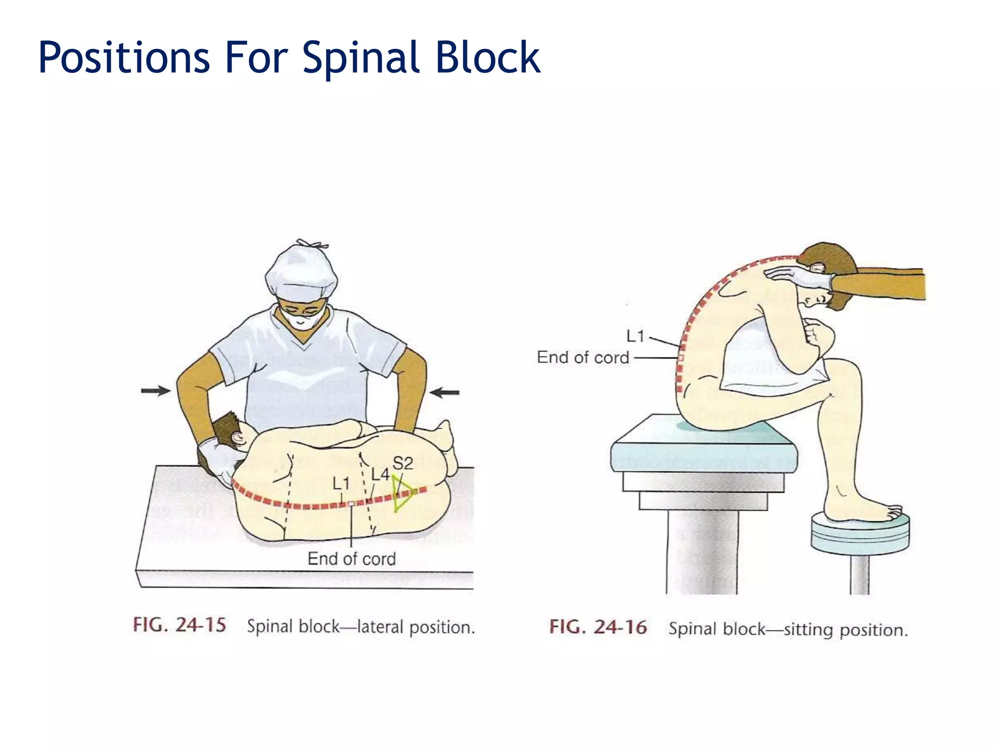 Local and regional anesthesia | PPT
