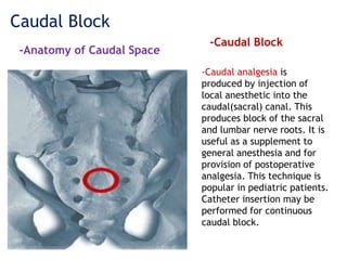 Local and regional anesthesia | PPT