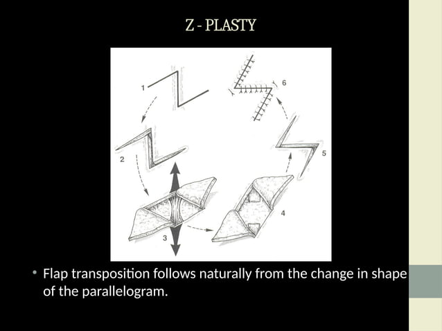 LOCAL AND REGIONAL FLAPS IN ORAL SURGERY.pptx | Cosmetic Medical ...