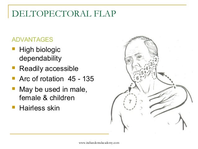 Local and regional flaps in head and neck cancer /certified fixed ort…