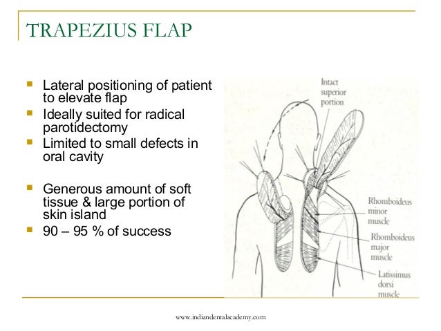 Local and regional flaps in head and neck cancer /certified fixed ort…