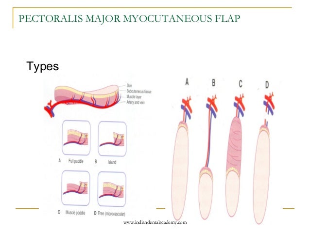 Local and regional flaps in head and neck cancer /certified fixed ort…