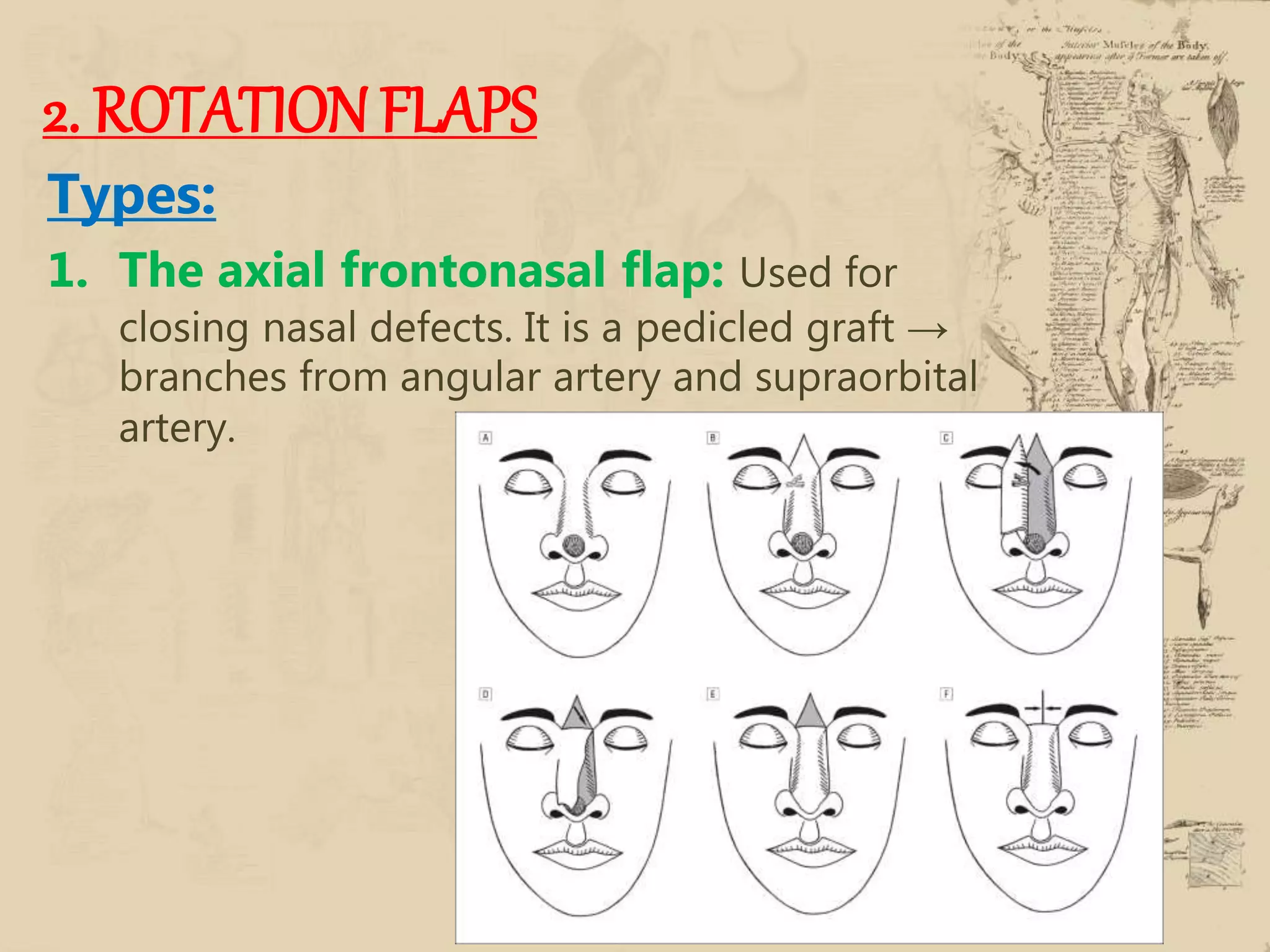 Local and regional flaps in head and neck reconstruction | PPTX