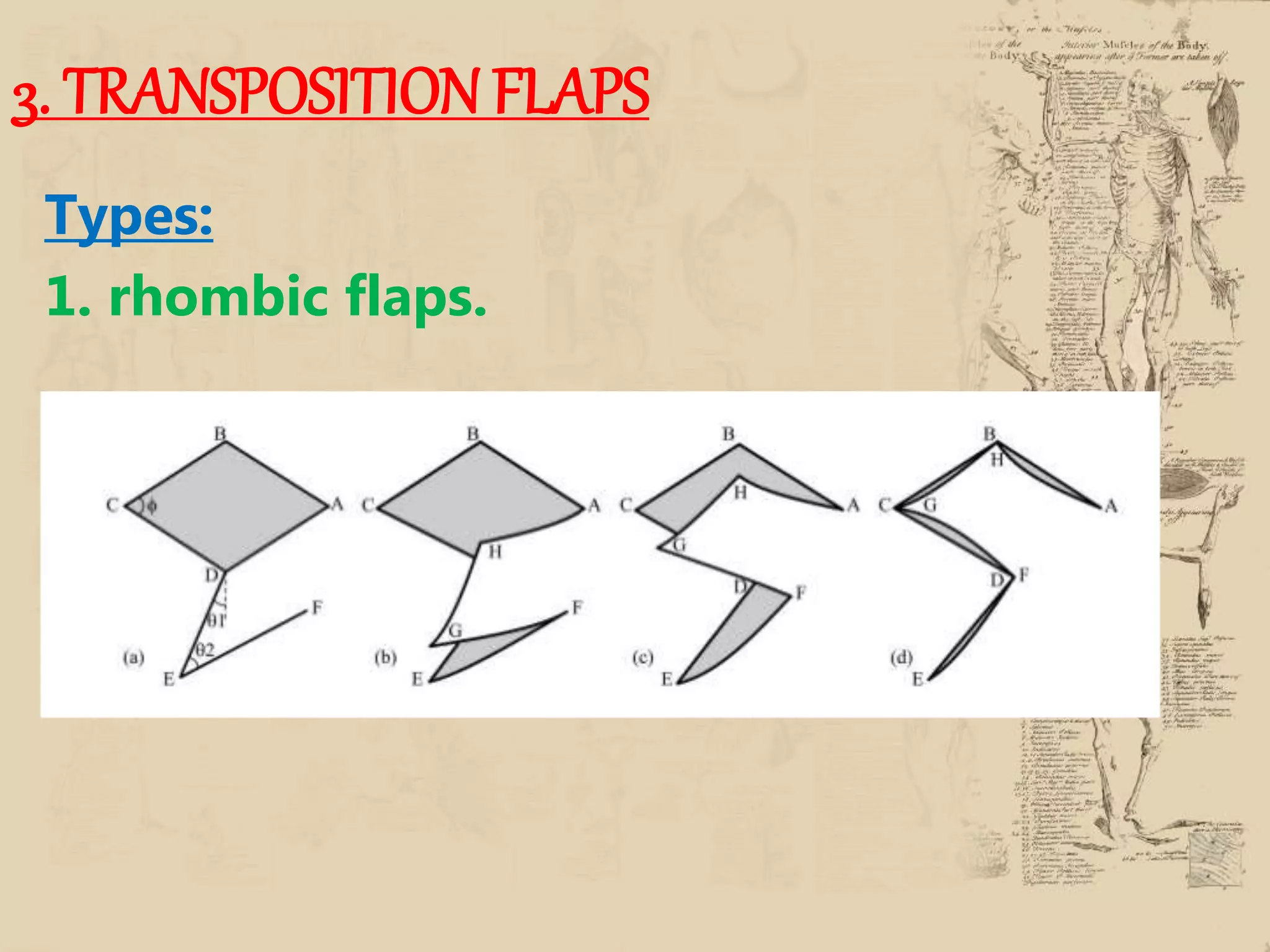 Local and regional flaps in head and neck reconstruction | PPTX