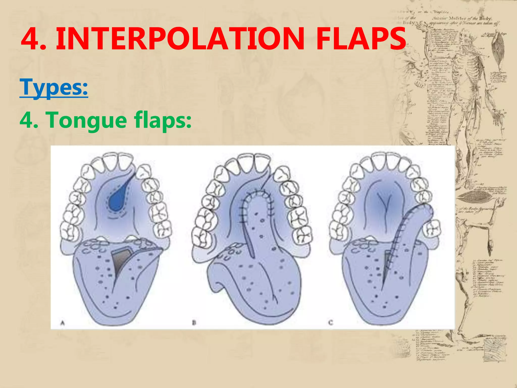 Local and regional flaps in head and neck reconstruction | PPTX