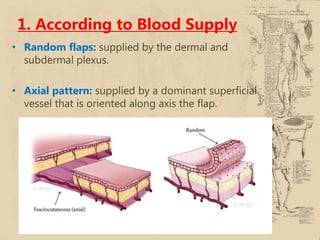 Local and regional flaps in head and neck reconstruction | PPTX