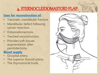 Local and regional flaps in head and neck reconstruction | PPTX
