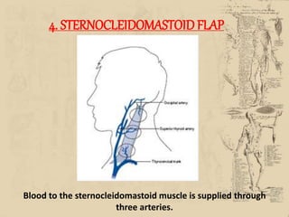 Local and regional flaps in head and neck reconstruction | PPTX