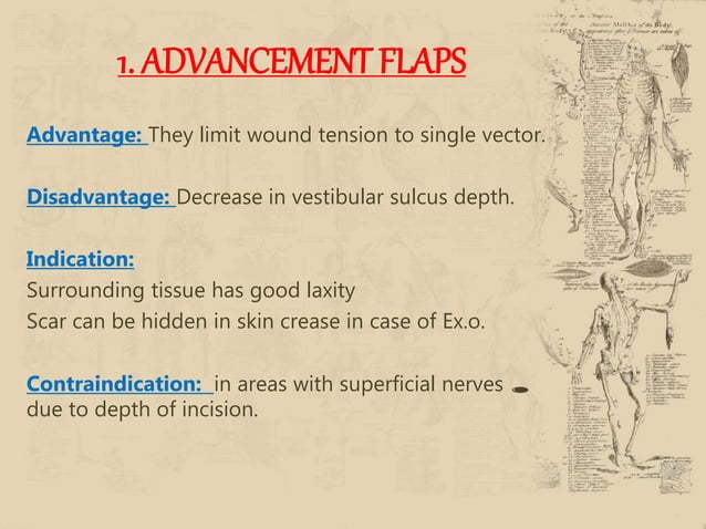 Local And Regional Flaps In Head And Neck Reconstruction Ppt