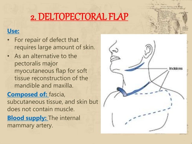 Local And Regional Flaps In Head And Neck Reconstruction Ppt
