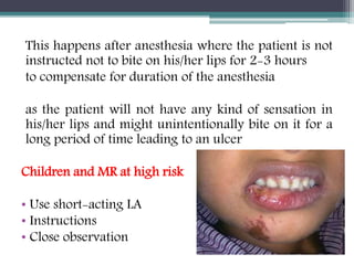 Local and systemic complications of local anesthesia | PPTX