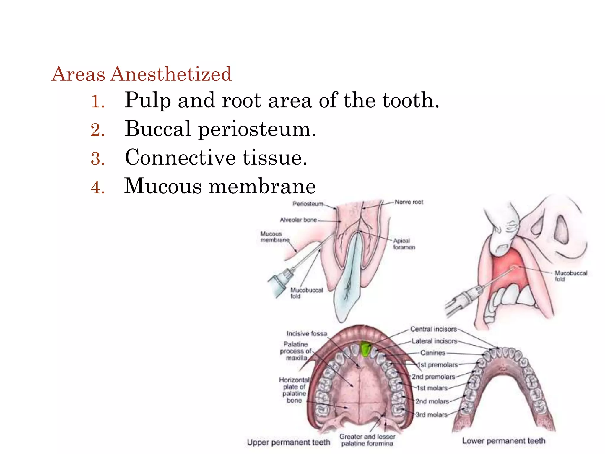 Local anesthesia | PPTX