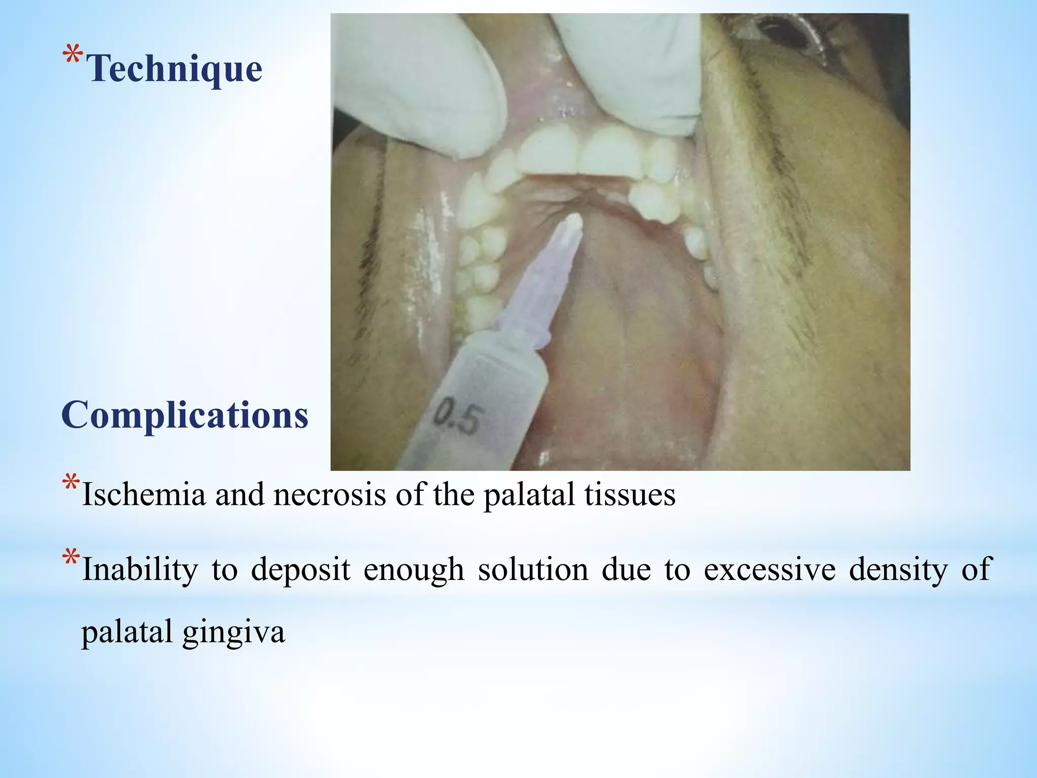 LOCAL ANESTHESIA.pptx