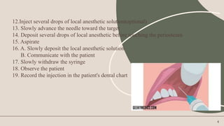 LOCAL ANESTHESIA.pptx
