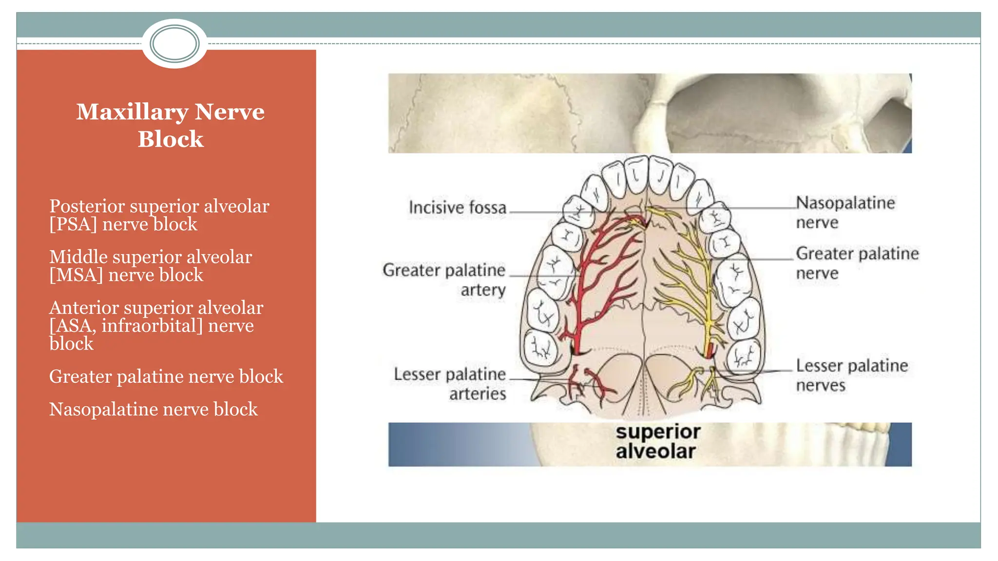 local anesthesia: Uses, Types, Side effects and Safety | PPTX