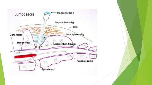 Local anesthesia in animals | PPTX | First Aid | Injuries