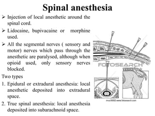 Local anesthesia and nerve blocks in large animals. | PPTX