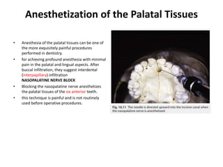 Local Anesthesia in childs , dentistry for adoleclsence | PPTX