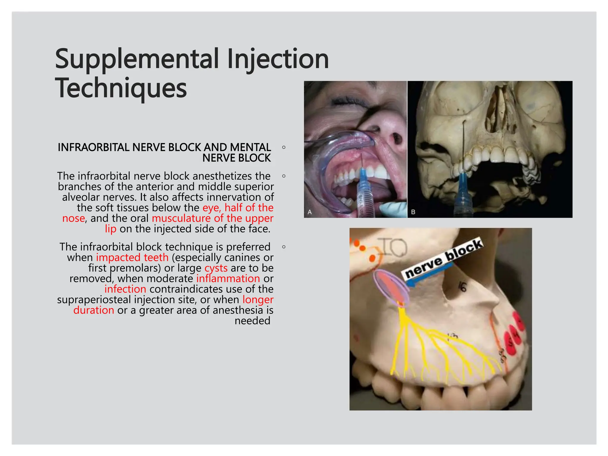 Local Anesthesia in childs [Autosaved].pptx
