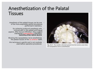 Local Anesthesia in childs [Autosaved].pptx