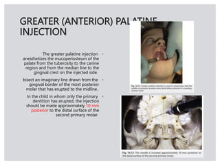 Local Anesthesia in childs [Autosaved].pptx