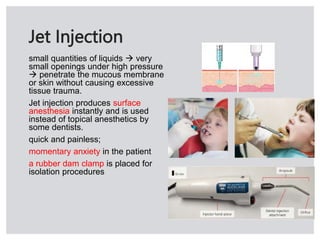 Local Anesthesia in childs [Autosaved].pptx