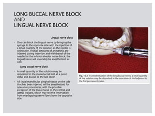 Local Anesthesia in childs [Autosaved].pptx