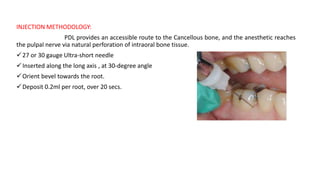 Local anesthesia in dentistry | PPTX