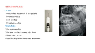 Local anesthesia in dentistry | PPTX
