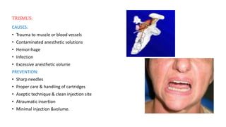 Local anesthesia in dentistry | PPTX