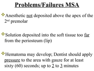 Local anesthesia in oral surgery and technique | PPT