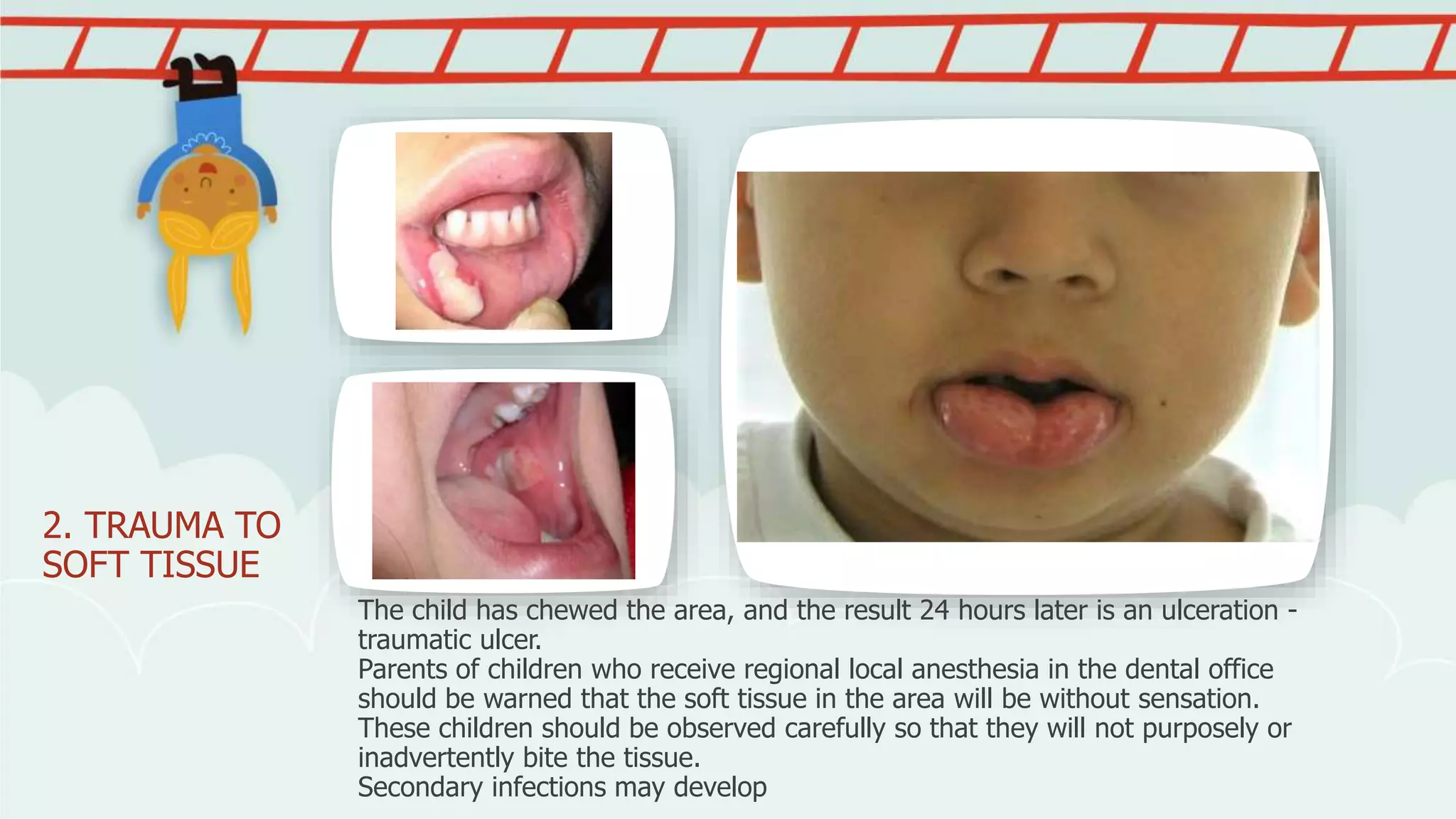 Local Anesthesia in Pediatric Dentistry.pptx