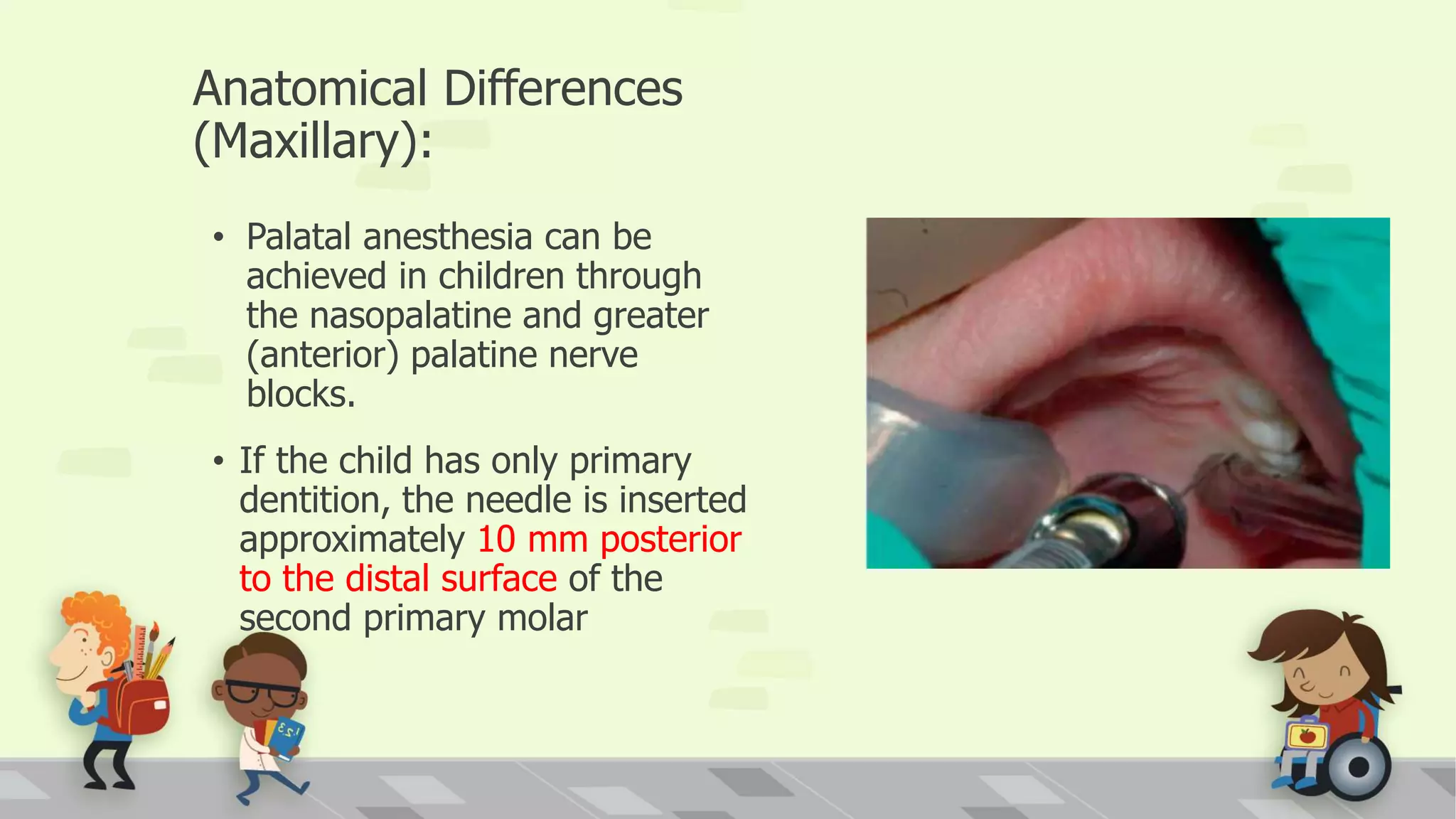 Local Anesthesia in Pediatric Dentistry.pptx