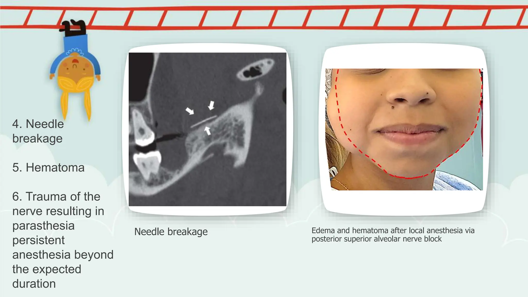 local anesthesiainpediatricdentistry.ppt