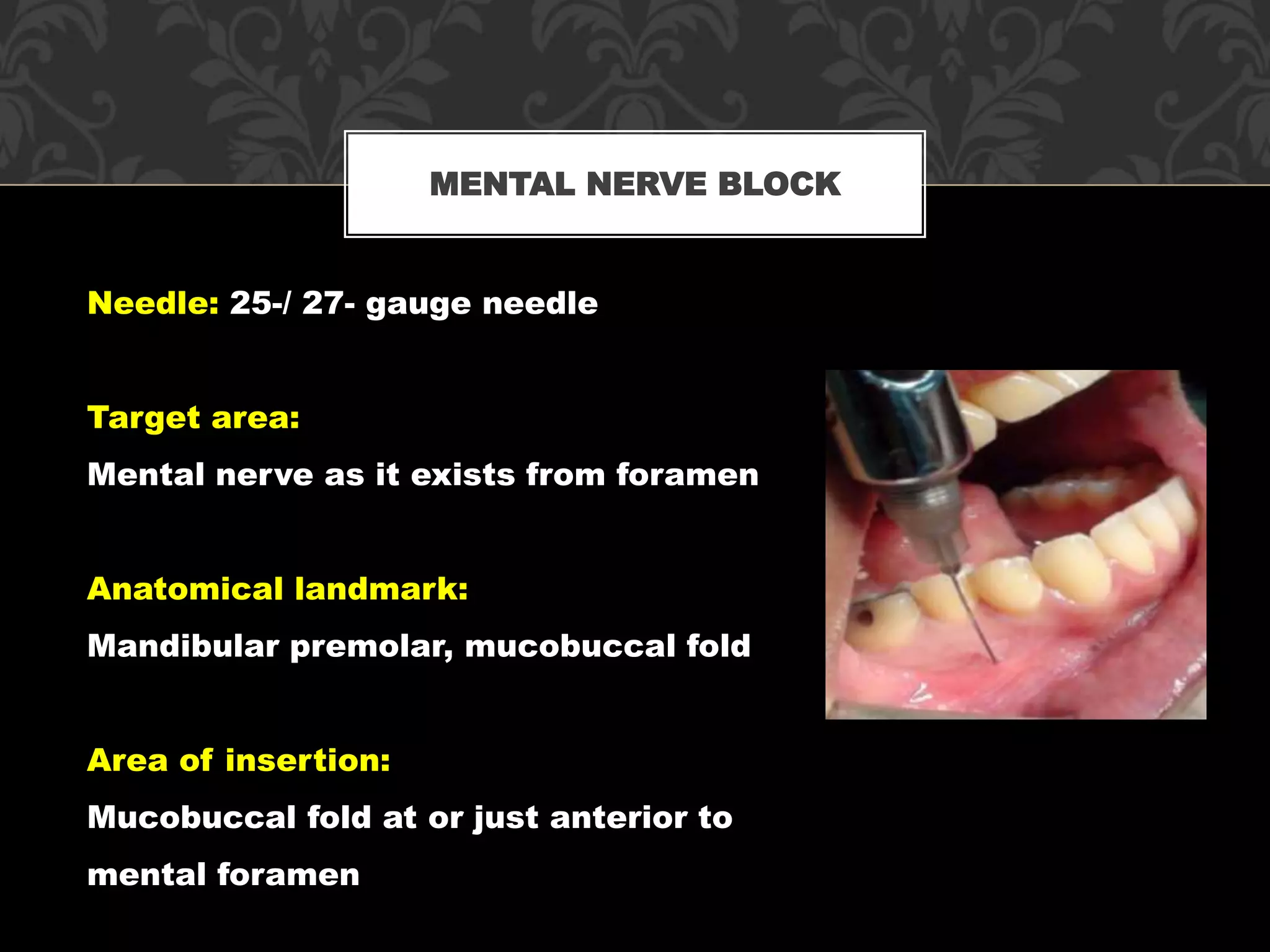 Local anesthesia IN PERIODONTICS DR.ANIZ.pptx