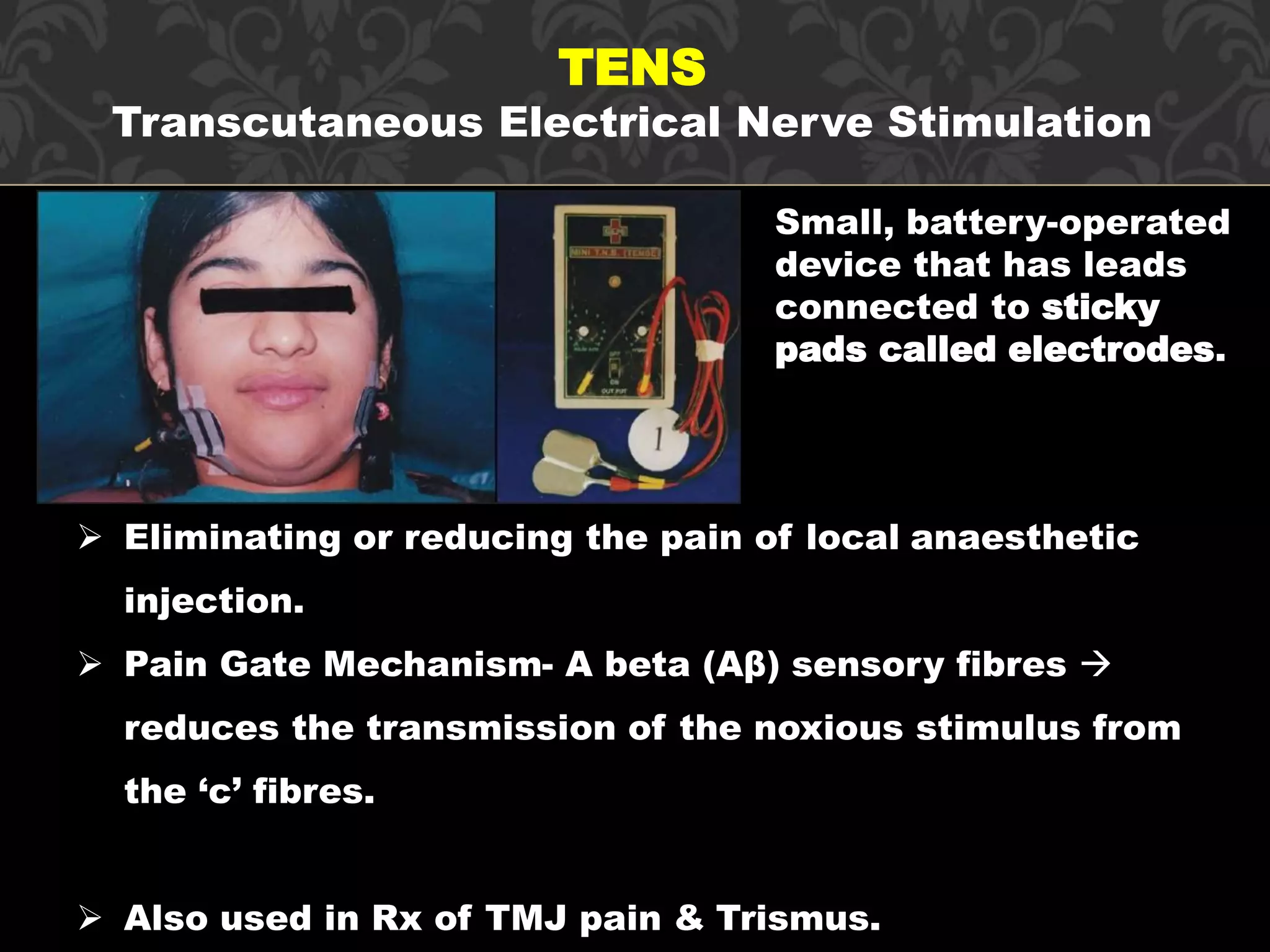 Local anesthesia IN PERIODONTICS DR.ANIZ.pptx