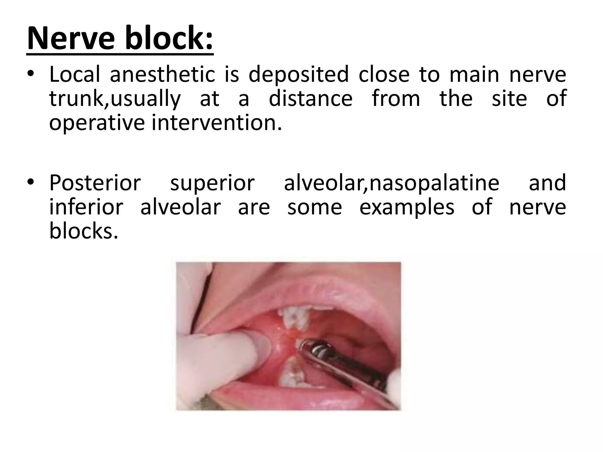 Local anesthesia ppt | PPTX
