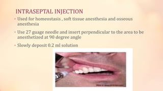 LOCAL ANESTHESIA TECHNIQUE.pptx