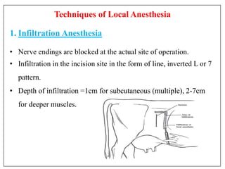 Local anesthesia techniques | PPT