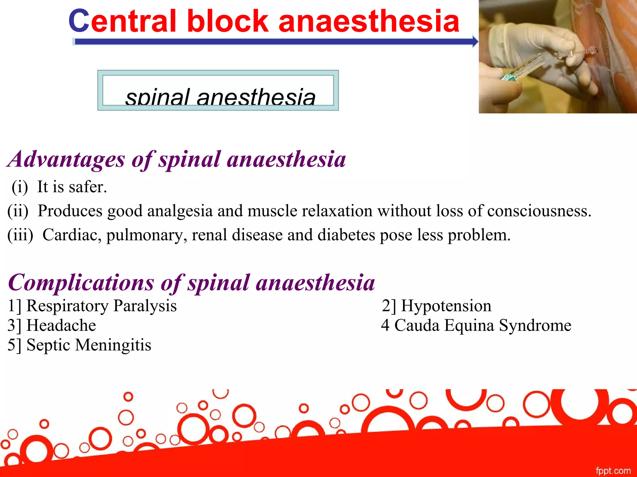 Local anesthetics | PPT