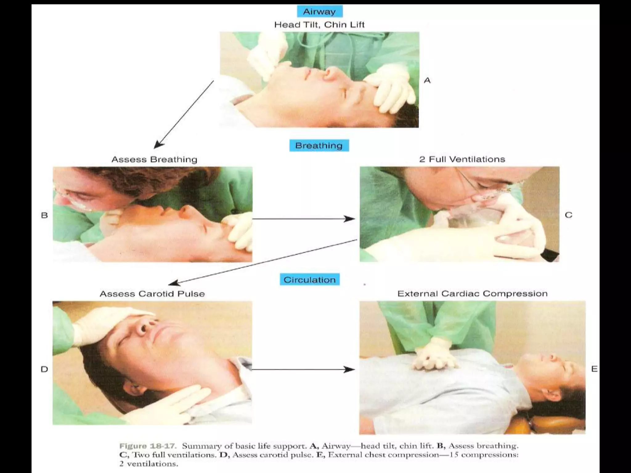 localanestheticscomplications-170125061150.pdf