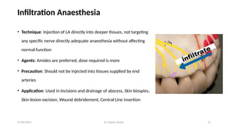 Mechanism of action of Local Anesthetics.pptx