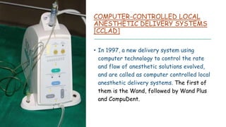 Local anesthetic techniques | PPTX