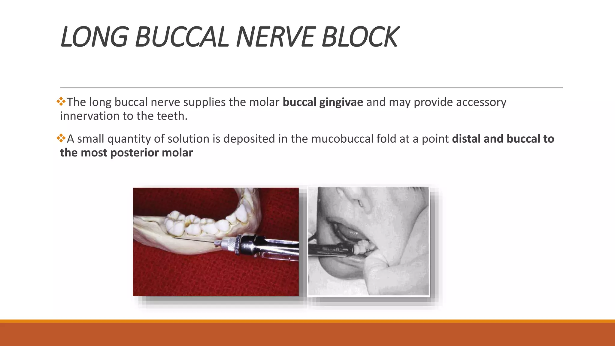 MANDIBULAR NERVE BLOCK in pediatric | PPTX