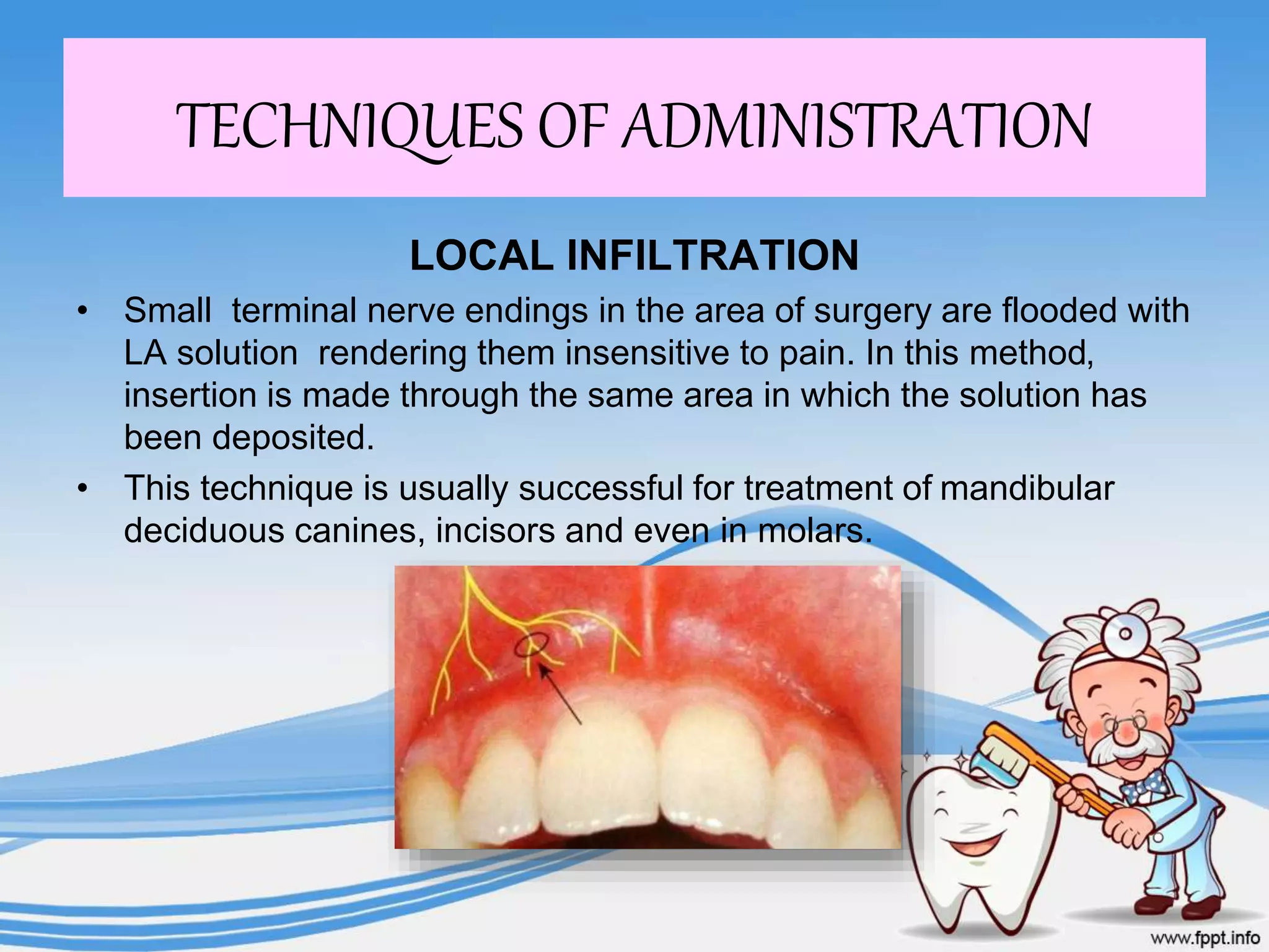 Local Anesthesia - Paedodontics | PPTX