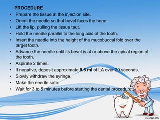 Local Anesthesia - Paedodontics | PPTX