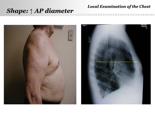 Local chest examination | PPT